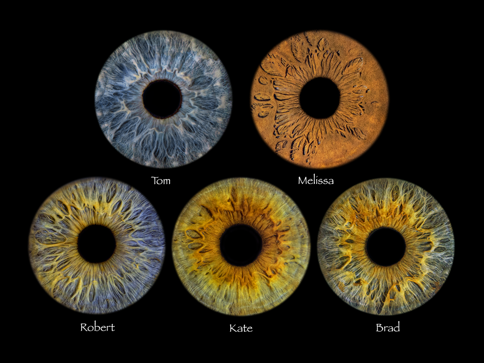 Five Eye Iris Photo – COSMIC EYE Iris Photo