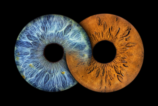 Couple Eye Iris Photo – COSMIC EYE Iris Photo