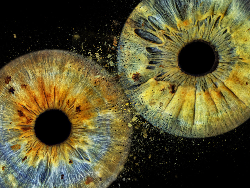 Couple Eye Iris Photo – COSMIC EYE Iris Photo